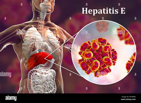Hepatitis E Banque De Photographies Et Dimages à Haute Résolution Alamy