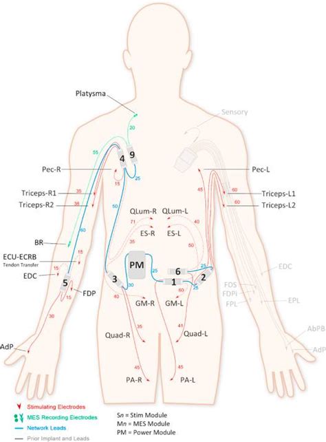 Neuroprosthetic Surgical Strategies For Neuromuscular Stimulation Clinical Tree