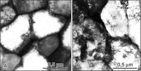 Microstructure Of Austenite In Initial State A And After Repeated γ