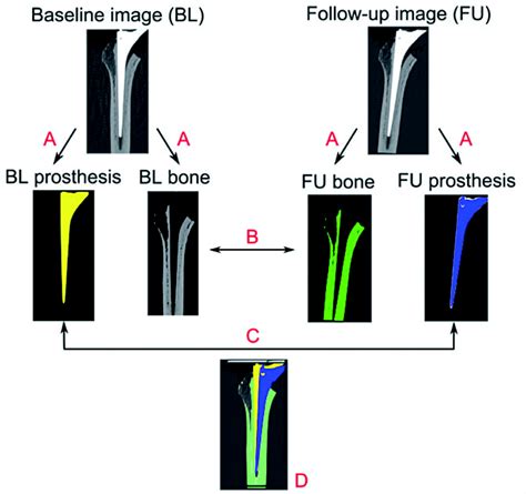 Schematic Representation Of The Proposed Method A Segmentation Of The Download Scientific