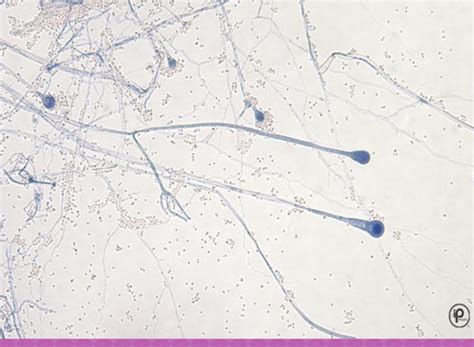 Mycology Practical Flashcards Quizlet