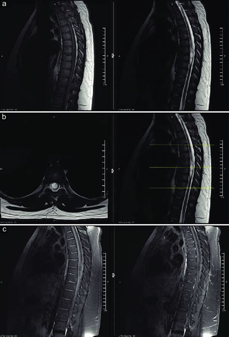 A Magnetic Resonance Imaging T1 And T2 Sagittal B Magnetic Download Scientific Diagram