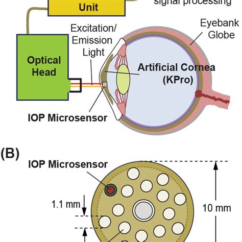 A The Novel Iop Monitoring Technology Our Pressure Microsensor Is Download Scientific