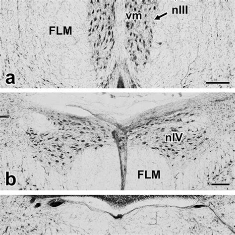 Photos And Photomicrographs Of Coronal Sections Through The Oculomotor