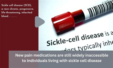 Sickle Cell Anemia Medication