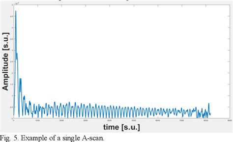 Figure 2 From Ultra Wideband Radar Based On Cots Components Semantic