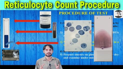 Reticulocyte Counting Procedure Youtube