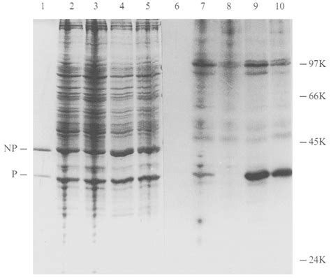 Summary Of The Purification Of Protein Kinase Activity From Hep 2 Cells