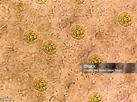 Microscopic View Of Stool Sample Showing Cyst Of Entamoeba Histolytica