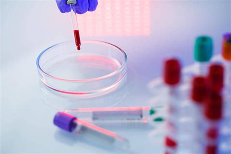 Lab Professionals Test For Bacteria In Human Body Photo Background And