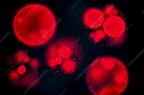 Volvox Aureus Algae Light Micrograph Stock Image C058 6473 Science Photo Library