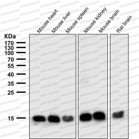 Anti Tomm20 Antibody R1c36antibodysystem