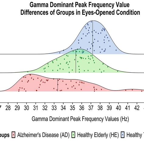 Three Highest Gamma Peak Frequency Differences Of The Groups In Download Scientific Diagram