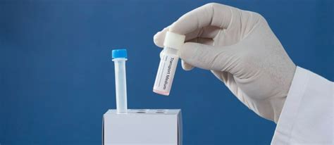 Laboratórios Federais De Defesa Agropecuária — Ministério Da Agricultura E Pecuária