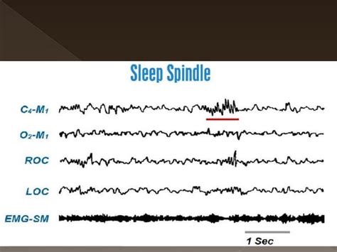 Sleep Scoring Newpptx