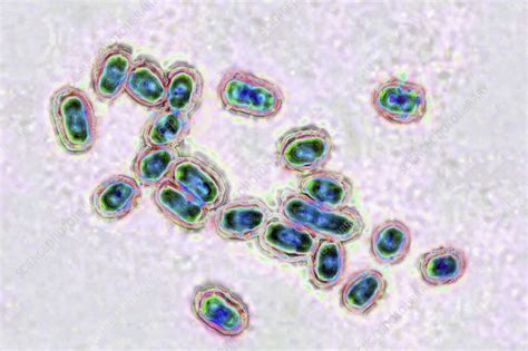 Streptococcus Pneumoniae Bacteria Light Micrograph Stock Image C061 0025 Science Photo