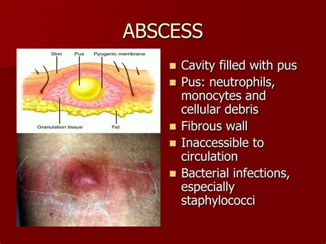 Ppt Inflammation Powerpoint Presentation Free Download Id1050617