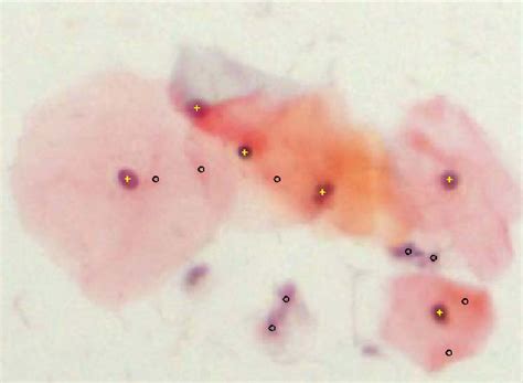 Figure 13 From Combining Shape Texture And Intensity Features For Cell Nuclei Extraction In Pap