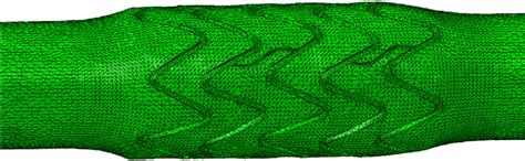 Section Of Volume Mesh Used In The Computational Fluid Dynamics Cfd Download Scientific