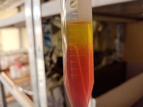 588 Questions With Answers In Bacteriology Science Topic