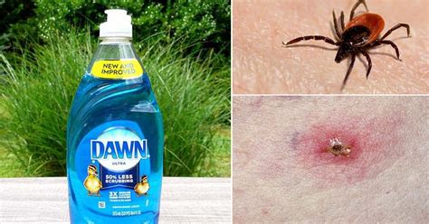 Does Dawn Kill Ticks Remove Ticks With Dawn Soap ⋆ Bright Stuffs