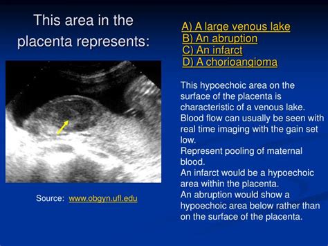Ppt Placental Us Powerpoint Presentation Id3356735