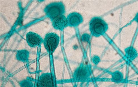 Ascomycetes Bilder Bläddra Bland 1529 Stockfoton Vektorer Och