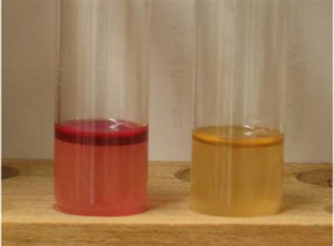 Module Additional Biochemical Tests To Identifty Gram Negative Bacteria IMVIC Flashcards