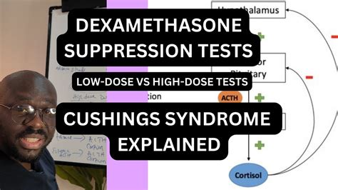 Dexamethasone Suppression Tests Explained Cushing Syndrome Medicine