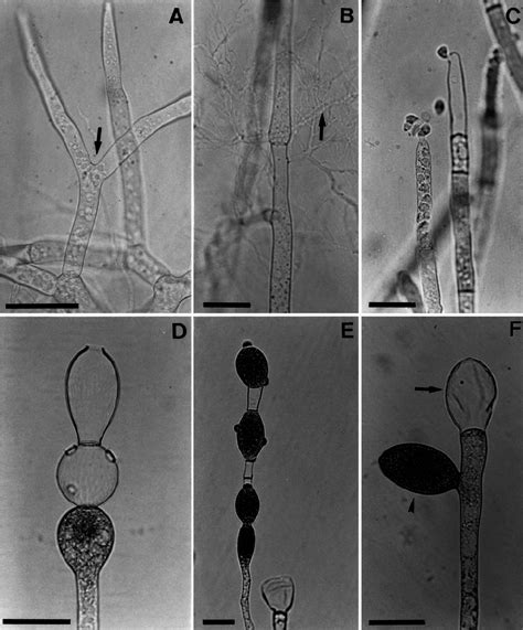 Morphological Characteristics Of Allomyces Arbuscula Njm 0212 A