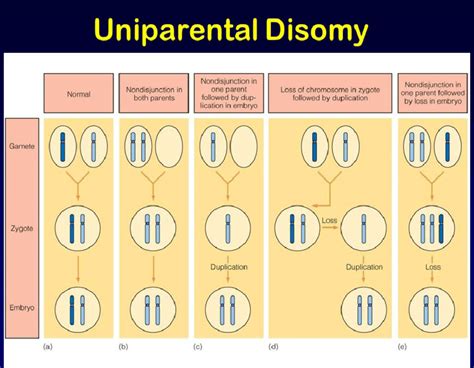 Monosomy Diagram