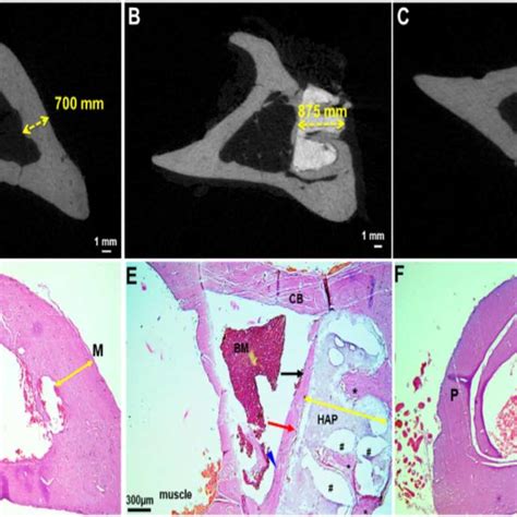 Representative Micro Ct Images Showing Rat Tibial Bone At Different Download Scientific Diagram
