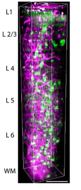 Development Of A Custom Made Three Photon Microscope To Perform Functional Imaging In Awake
