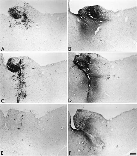 Interconnected Parallel Circuits Between Rat Nucleus Accumbens And Thalamus Revealed By