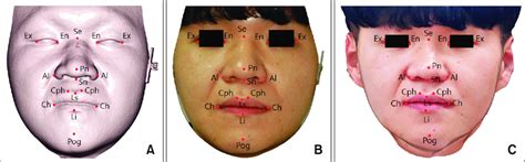 Landmark Identification On Cone Beam Computed Tomography Soft Tissue Download Scientific