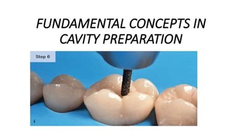 Class V And Vi Amalgam Cavity Preparations Pptx