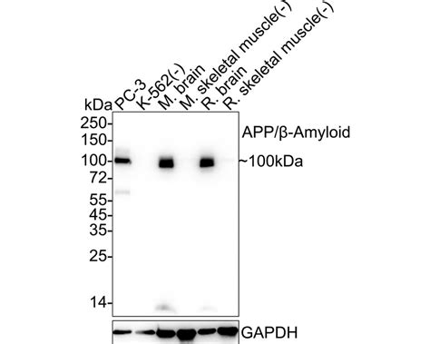 Amyloid Precursor Protein Recombinant Rabbit Monoclonal Antibody Je30