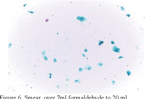 Figure 6 From Use Of Formaldehyde To Increase Result Quality In Urinary Cytology Semantic Scholar