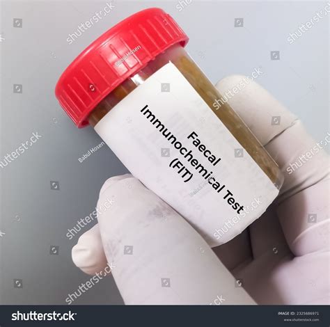 Faecal Occult Test Photos Images And Pictures Shutterstock