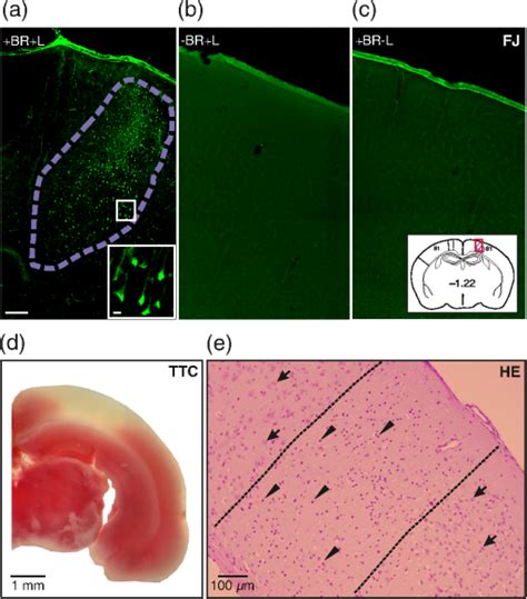 In Vivo Brain Imaging With Multimodal Optical Coherence Microscopy In A Mouse Model Of