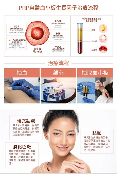 Prp注射療法是什麼？