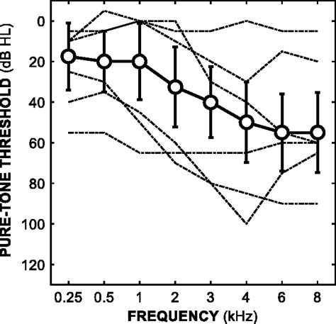 Median Pure Tone Thresholds As A Function Of Frequency Across All 38