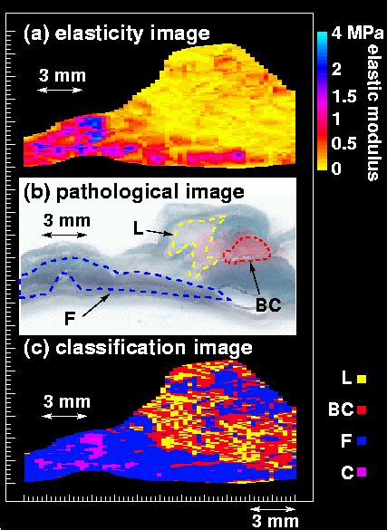 a shows an elasticity image measured in vitro and fig 3 b shows the