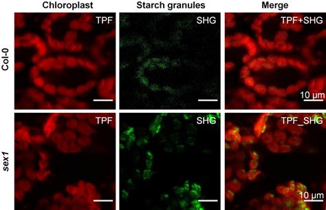 Two Photon Fluorescence Tpf And Second Harmonic Generation Shg