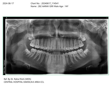 282 Aarav Giri 2024 06 17115005 Pdf