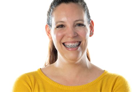 Adult Braces Realizing You Might Need Braces Later In Life