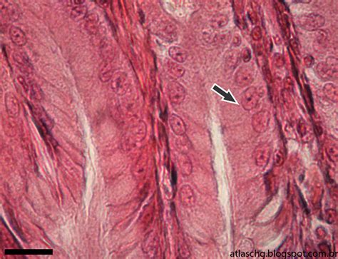Atlas De Citologia E Histologia Tecido Epitelial De Revestimento