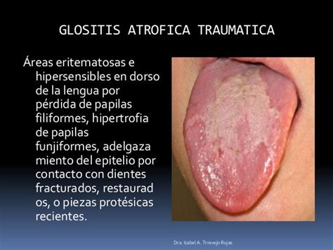 Lesiones Fisicas Y Quimicas