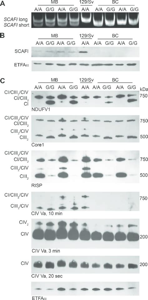 Scafi Allele Status And Its Effect On Supercomplex Assembly In Bcs1l