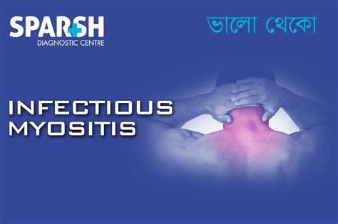 Infectious Myositis Sparsh Diagnostic Center